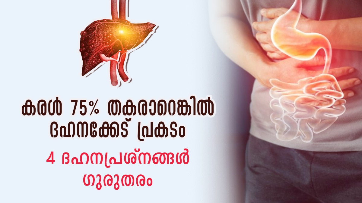 വയര്‍വീര്‍ക്കല്‍, വയറുവേദന, മലബന്ധം: സ്ഥിരമെങ്കില്‍ കരള് ...