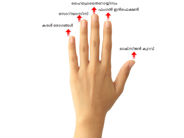 ഓരോ നഖത്തിനു പിന്നിലും ഓരോ രോഗങ്ങള്‍ | Nail Symptoms and What They Mean ...