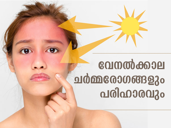വേനല്‍ സമ്മാനിക്കും ഈ ചര്‍മ്മ പ്രശ്‌നങ്ങള്‍; ശ്രദ്ധിക്കണം | Common Skin ...