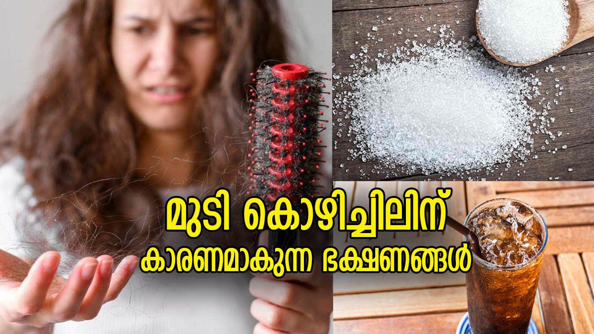 കഷണ്ടിയാകാന്‍ വേറെ വഴിതേടണ്ട, മുടി കൊഴിച്ചില്‍ കൂട്ടും ഈ ഭക്ഷണങ്ങള് ...